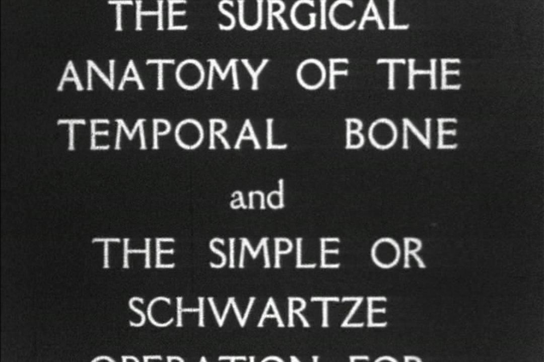Surgical anatomy of temporal bone and the simple or Schwartze operation ...