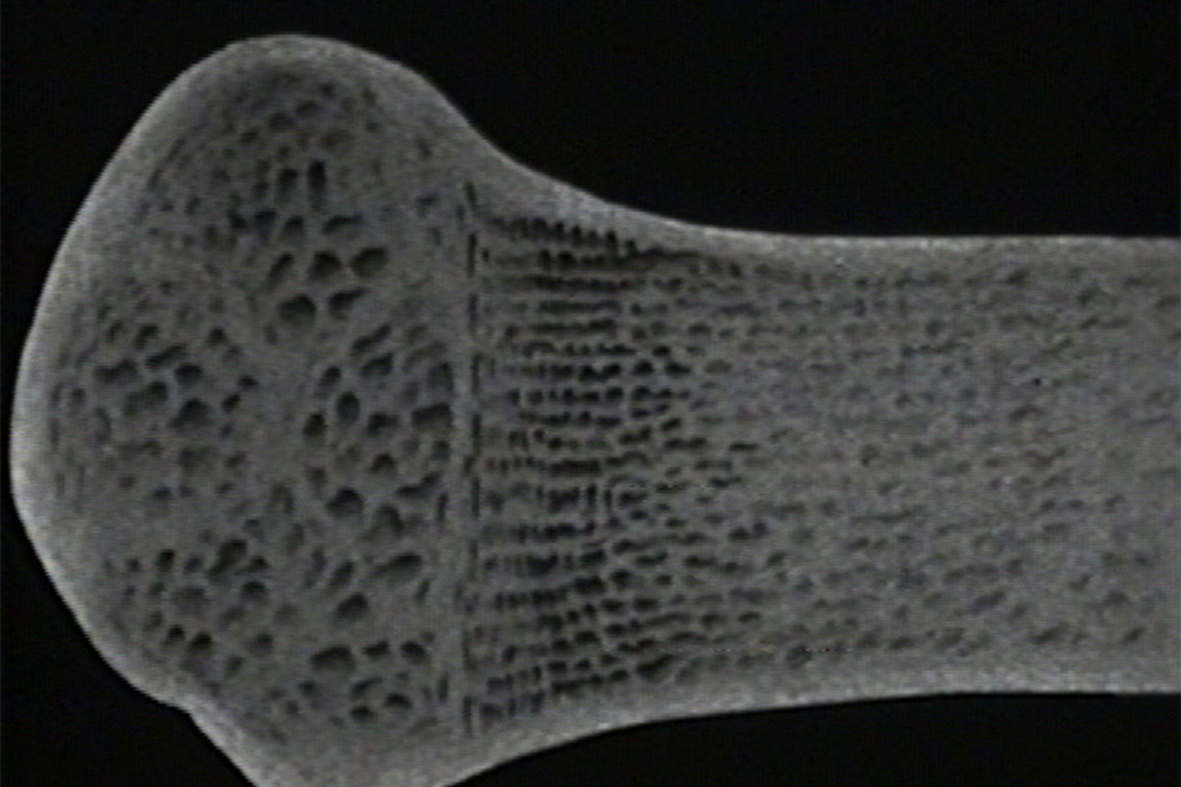 Cell division in the cartilage plate during bone growth – London's ...